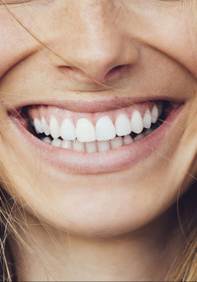 Gummy smile - House of Bratz